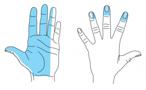 Median nerve block
